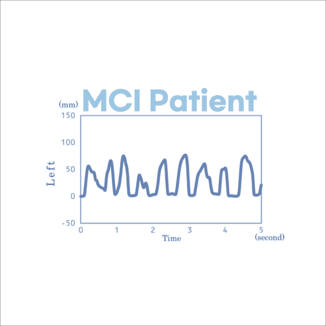 Callus Sprint Program